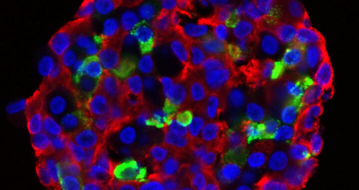 Maike Sander receives 2022 Albert Renold Prize | Max Delbrück Center