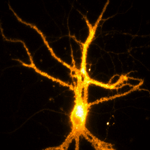 Systems Biology Imaging | Max Delbrück Center for Molecular Medicine