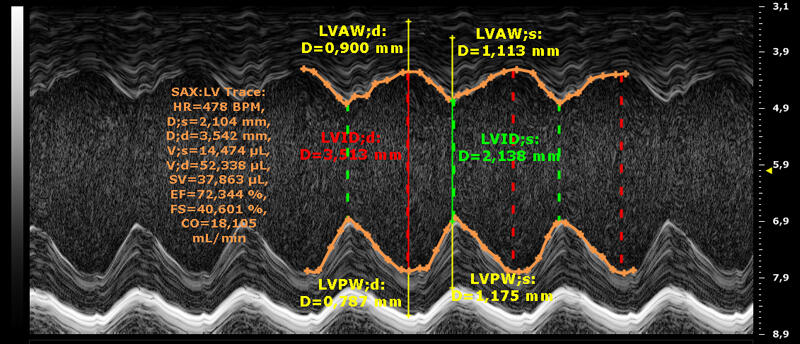 Hochfrequenz Ultraschall | Max Delbrück Center