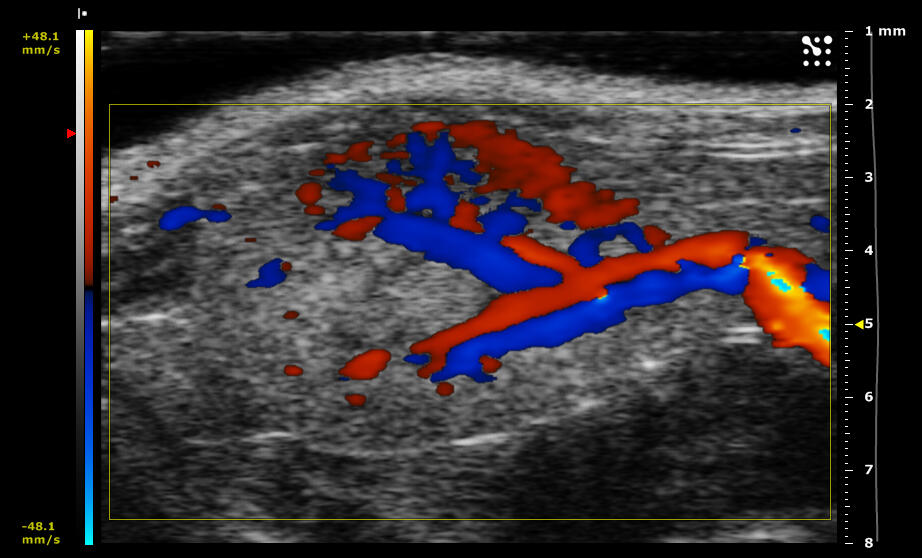 High-Frequency Ultrasound | Max Delbrück Center