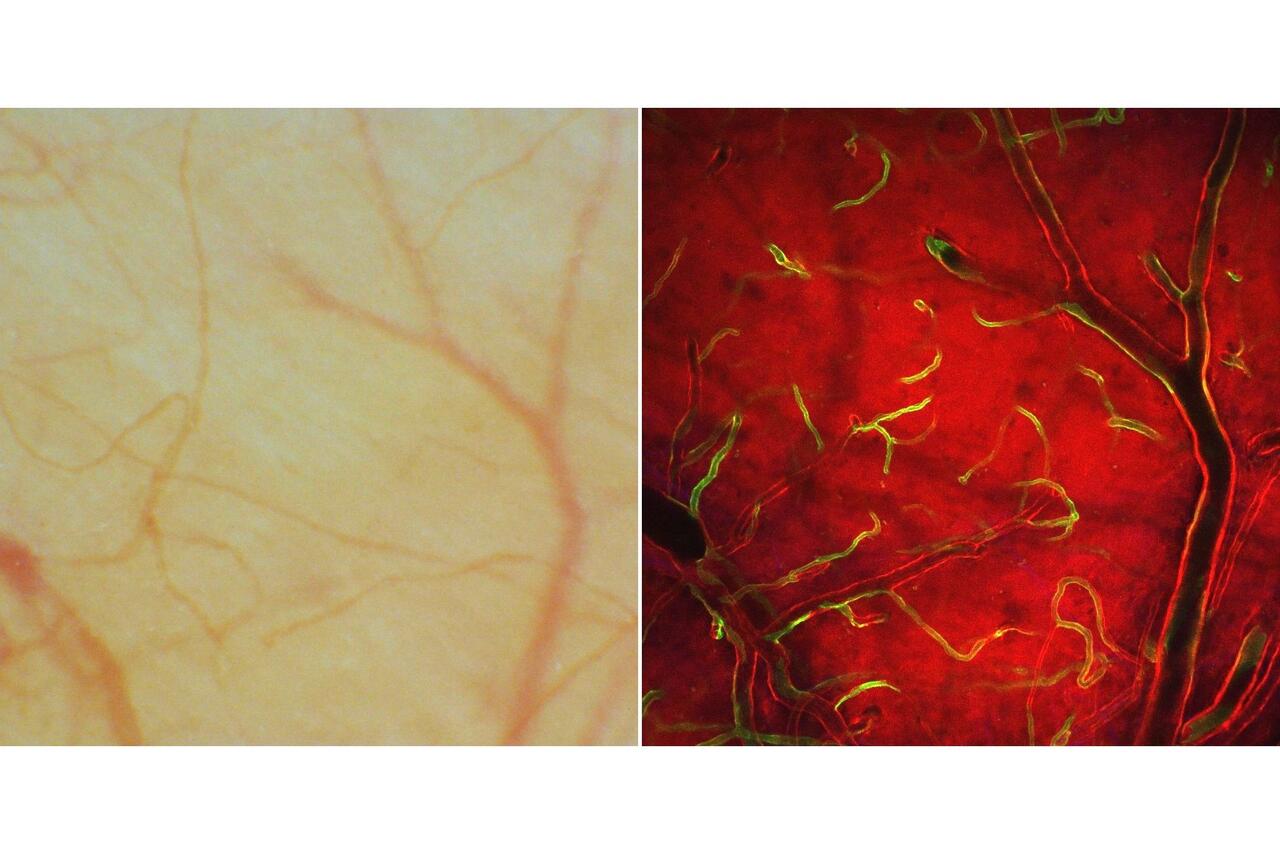 Multiphoton Intravital Microscopy | Max Delbrück Center