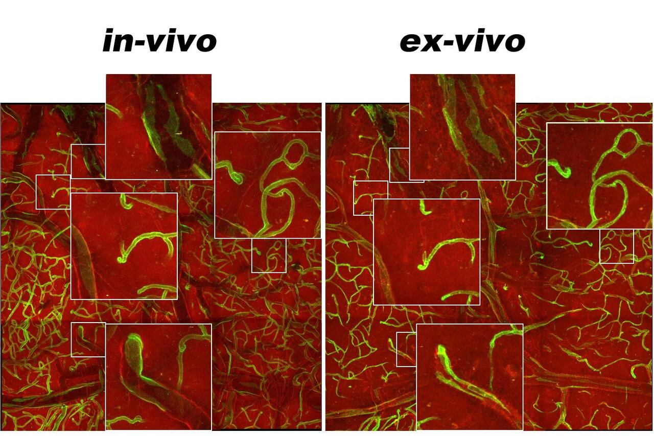 Multiphoton Intravital Microscopy | Max Delbrück Center