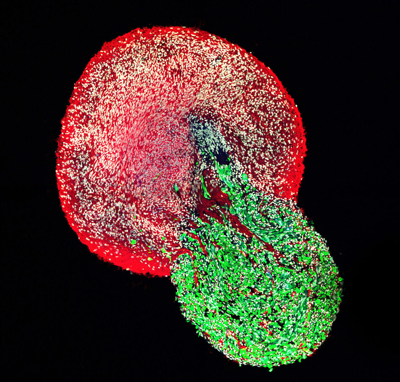 Organoids and sequencing team up for ALS research | Max Delbrück Center