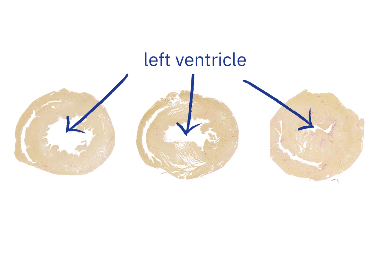 No heart damage despite hypertension | Max Delbrück Center
