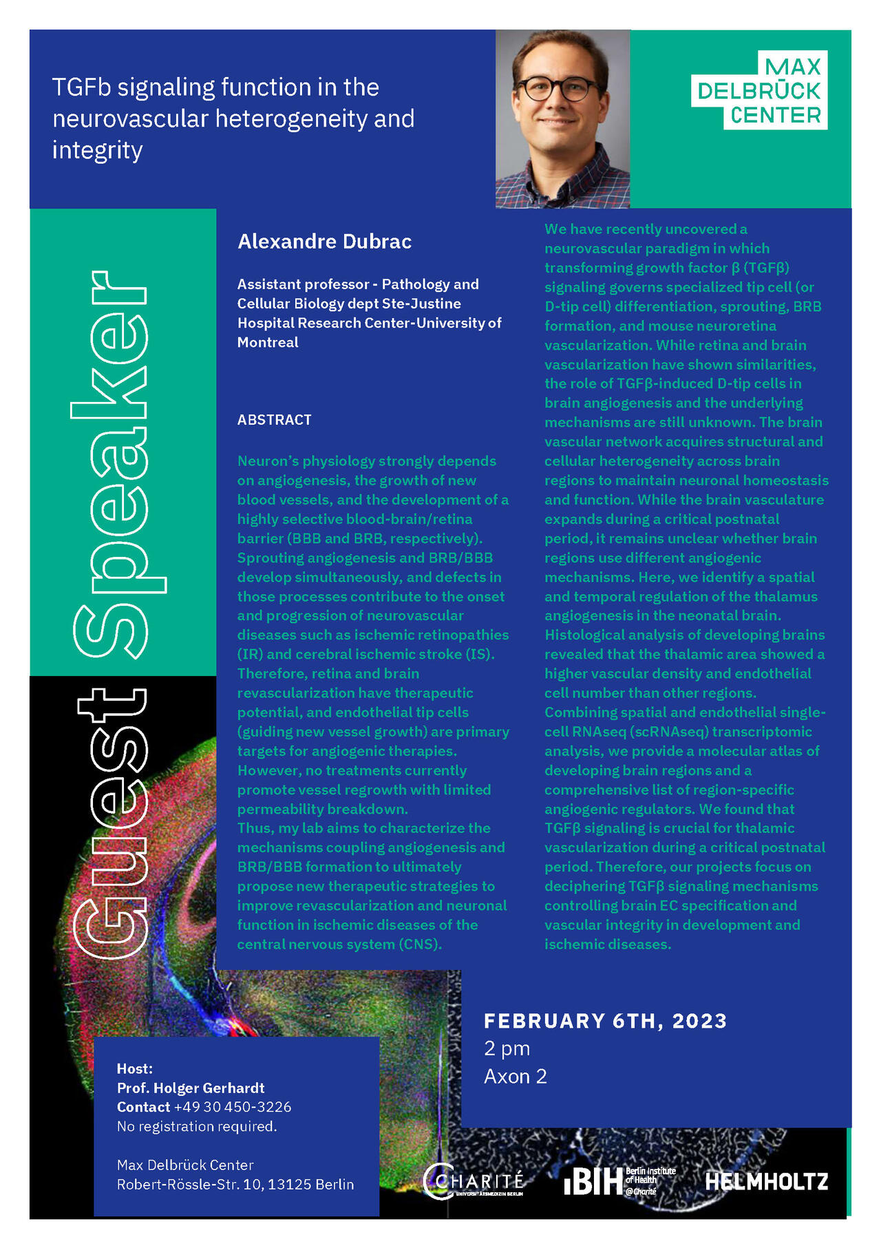 Alexandre Dubrac: TGFb signaling function in the neurovascular ...