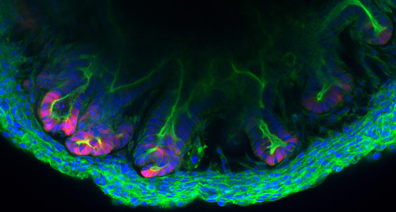 Colon tissue made in the lab | Max Delbrück Center