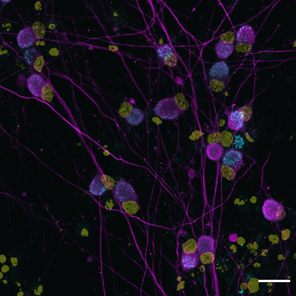 Sensory Neuron Microscope