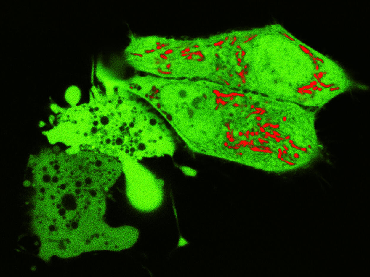 Lebenden Zellen bei der Arbeit zuschauen | Max Delbrück Center