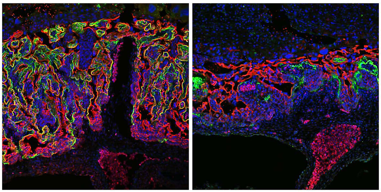 MDC Researchers Discover New Signaling Pathway in Embryonic Development ...