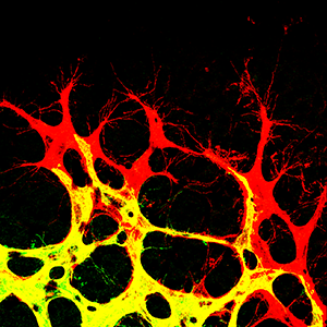 Wer übernimmt die Führung? Der Wettstreit der Zellen in Blutgefäßen ...