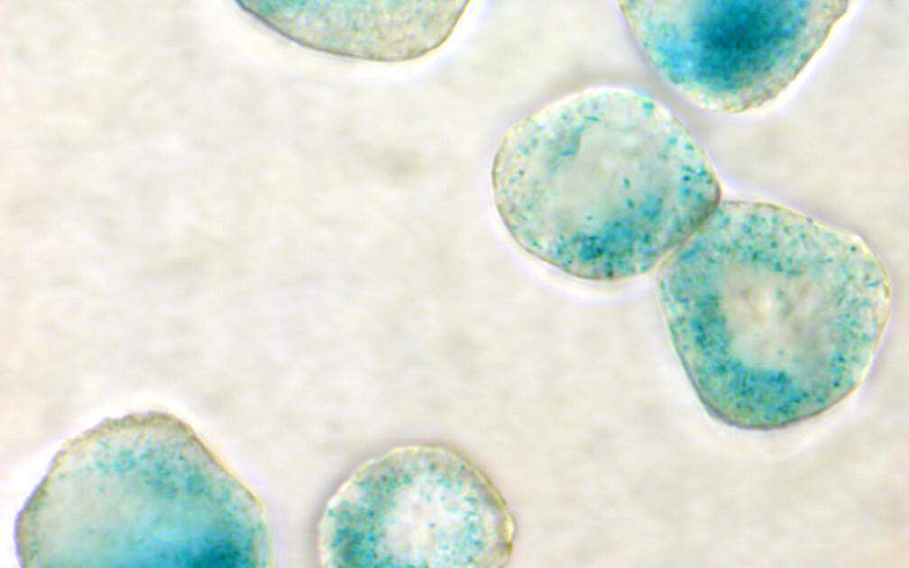 Dormant and aggressive stem cells | Max Delbrück Center