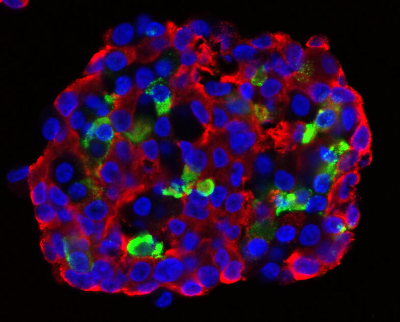 Maike Sander receives 2022 Albert Renold Prize | Max Delbrück Center