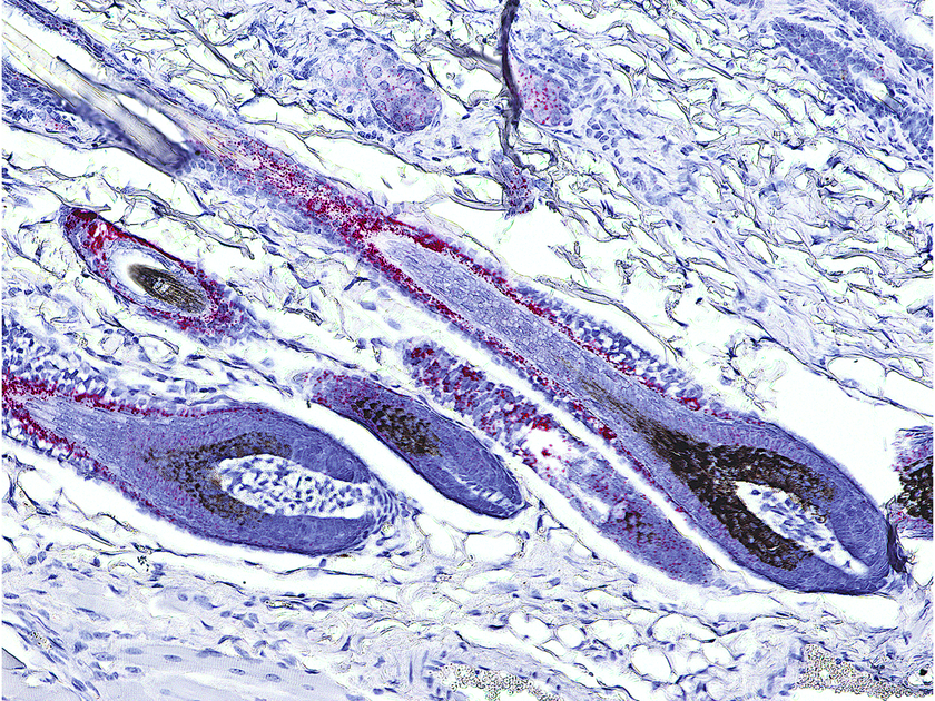 Treating skin diseases with ACE2 inhibitors | Max Delbrück Center