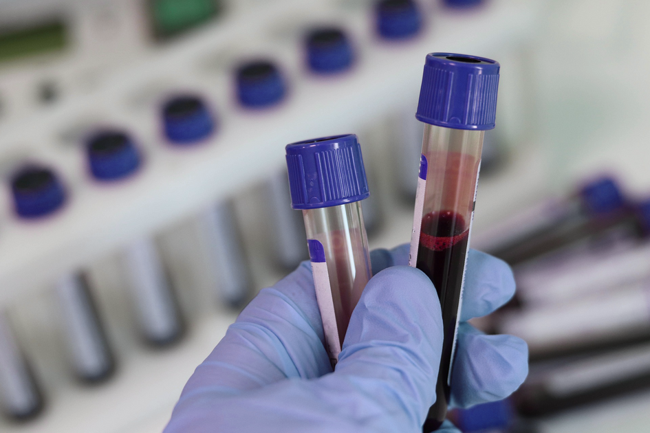A blood test to detect immune deficiency | Max Delbrück Center